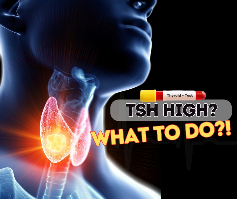 Thyroid Shock: Alarming Signals of Abnormal TSH Levels - Dallas Primary ...